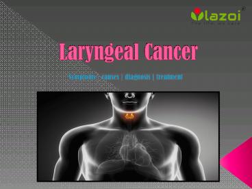 PPT – Signs, Symptoms and Treatment of Laryngeal Cancers PowerPoint presentation | free to ...