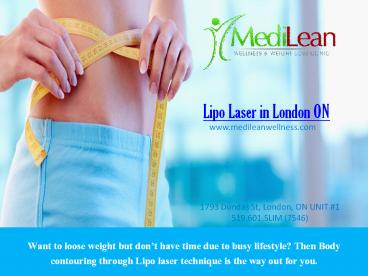 Lipo laser in London ON presentation | free to download
