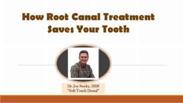 PPT – How Root Canal Treatment Saves Your Tooth PowerPoint presentation ...