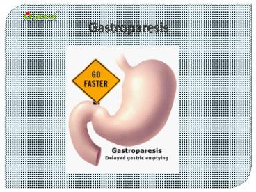 PPT – Gastroparesis: Causes, Symptoms, Diagnosis and Treatment ...