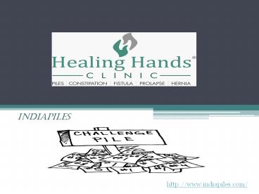 Mulvyadh Piles symptoms| By Dr.Ashwin Porwal|Indiapiles presentation ...