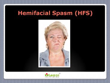 Hemifacial Spasm: Overview of symptoms, causes and treatment ...