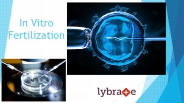 In-Vitro Fertilization presentation | free to download