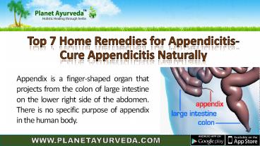 PPT – Top 7 Home Remedies for Appendicitis- Cure Appendicitis Naturally ...