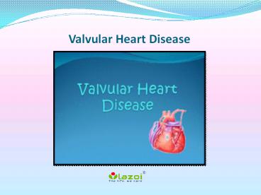 Valvular Heart Disease: Symptoms, Causes, Diagnosis and Treatment ...