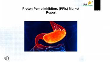 PPT – Proton Pump Inhibitors PPIs Market Research Report 2017 ...