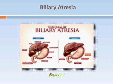 Biliary Atresia presentation | free to download