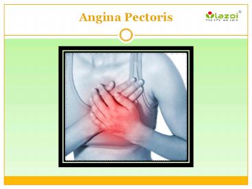 Angina Pectoris: Risk factors, Symptoms, Diagnosis and Treatment (1 ...