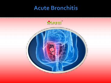 Acute bronchitis: Causes, symptoms and treatment (1) presentation ...