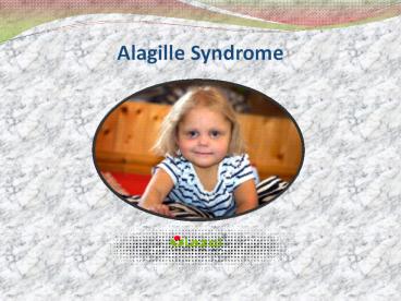 Alagille Syndrome: Causes, symptoms and treatment (1) presentation ...