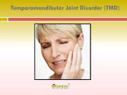 PPT – TMJ and Temporomandibular Joint Disorder PowerPoint presentation ...