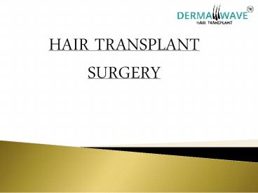 PPT – Hair Transplant Surgery PowerPoint presentation | free to ...