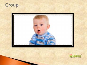 Croup presentation | free to download