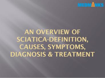 AN OVERVIEW OF SCIATICA-DEFINITION, CAUSES, SYMPTOMS, DIAGNOSIS ...