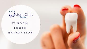Explanation of Wisdom Tooth Extraction Procedure presentation | free to ...