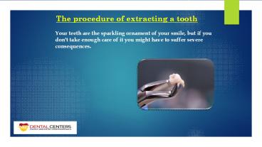 PPT – tooth extraction PowerPoint presentation | free to download - id ...