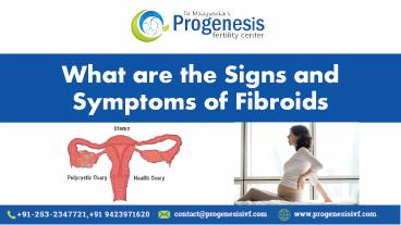 PPT – What are the Signs and Symptoms of Fibroids PowerPoint ...