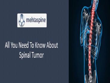 PPT – All You Need To Know About Spinal Tumor PowerPoint presentation ...