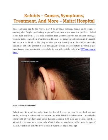 Keloids – Causes, Symptoms, Treatment, And More - Maitri Hospital ...