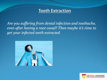 Tooth Extraction (2) presentation | free to download