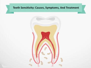 Teeth Sensitivity: Causes, Symptoms, And Treatment presentation | free ...