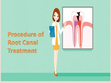 Root Canal Treatment Process presentation | free to download