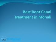 PPT – Root Canal Treatment in Tricity PowerPoint presentation | free to ...