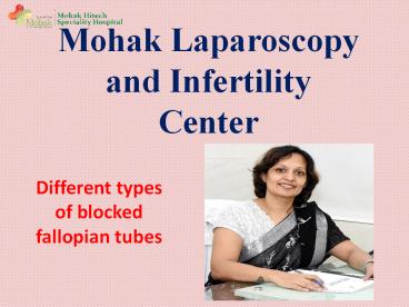 PPT – Different types of blocked fallopian tubes PowerPoint ...