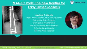 MAGEC Rods : The new frontier for Early Onset Scoliosis presentation ...