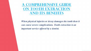 Tooth Extraction (4) presentation | free to download