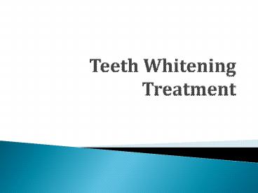 PPT – Teeth Whitening Treatment PowerPoint presentation | free to ...