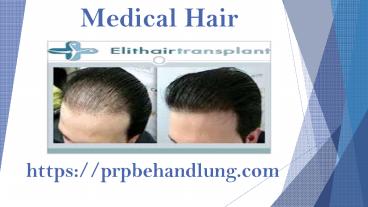 PPT – Prp Behandlung Berlin PowerPoint presentation | free to download - id: 904a2c-MTMwM