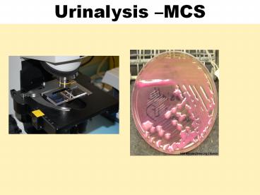 Urine Analysis, Urine MCS presentation | free to view