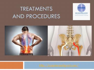 PPT – Back Physical Therapy New York PowerPoint presentation | free to ...