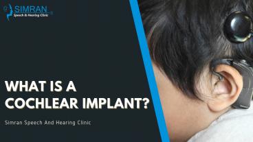 PPT – What Is A Cochlear Implant PowerPoint presentation | free to ...