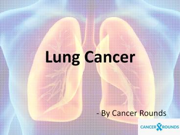 PPT – Lung Cancer PowerPoint presentation | free to download - id ...