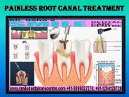 PPT – Root Canal Treatment in Tricity PowerPoint presentation | free to ...