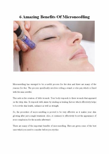 6 Amazing Benefits Of Microneedling presentation | free to download
