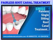 PPT – Painless Root Canal Treatment in Affordable Prices at Faridabad PowerPoint presentation ...