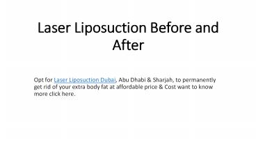Laser Liposuction Before and After presentation | free to download