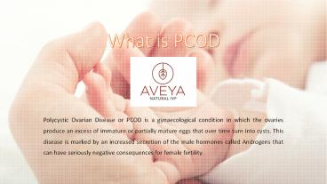 PPT – PCOD Important Aspects To Keep In Mind About This Condition ...