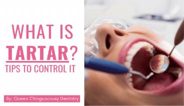 What is Tartar & Tips to Control It? By QC Dentistry Brampton ...