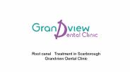 PPT – Root Canal Treatment in Tricity PowerPoint presentation | free to ...