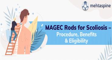 PPT – MAGEC Rods for Scoliosis – Procedure, Benefits & Eligibility ...