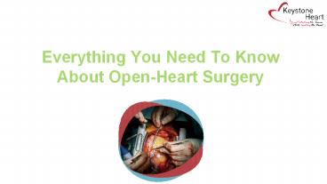PPT – Everything You Need To Know About Open-Heart Surgery PowerPoint ...