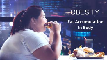 OBESITY- Fat Accumulation In Body presentation | free to download