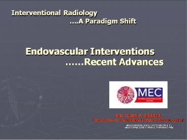 Endovascular Interventions - Endovascular Therapy - Endovascular ...