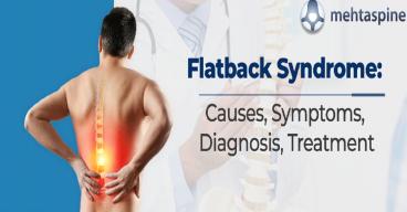 PPT – Flatback Syndrome: Causes, Symptoms, Diagnosis and Treatment ...