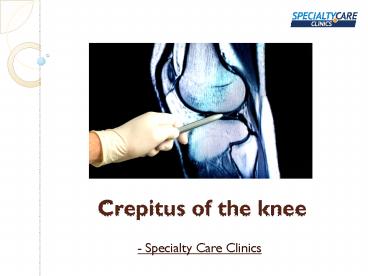 PPT – Unusual Knee Popping or Cracking: Crepitus PowerPoint ...