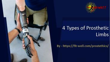 4 Types of Prosthetic Limbs presentation | free to download